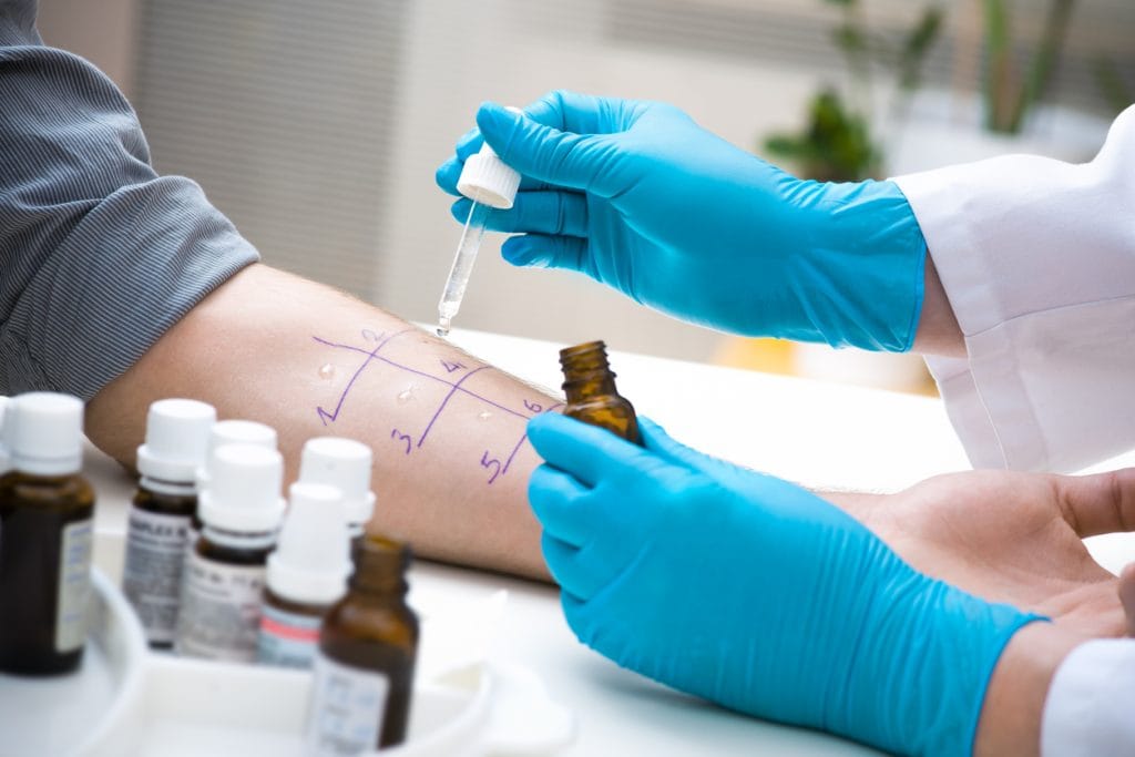 Allergy Testing Services | ZPlus Clinics